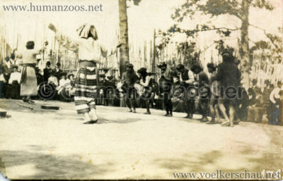 1904 St. Louis World’s Fair – Human Zoos